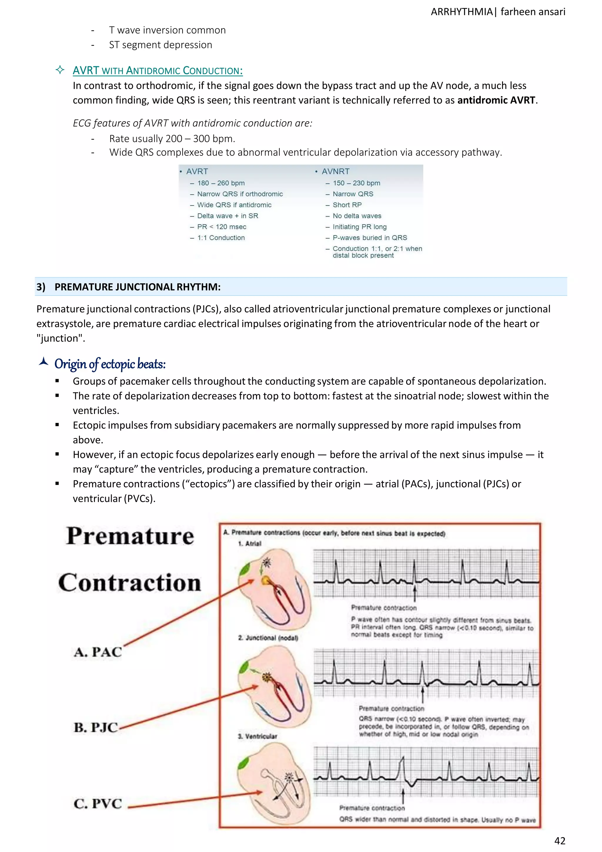 Arrhythmia: Mechanism, Classification, ECG features | PDF | Heart and ...