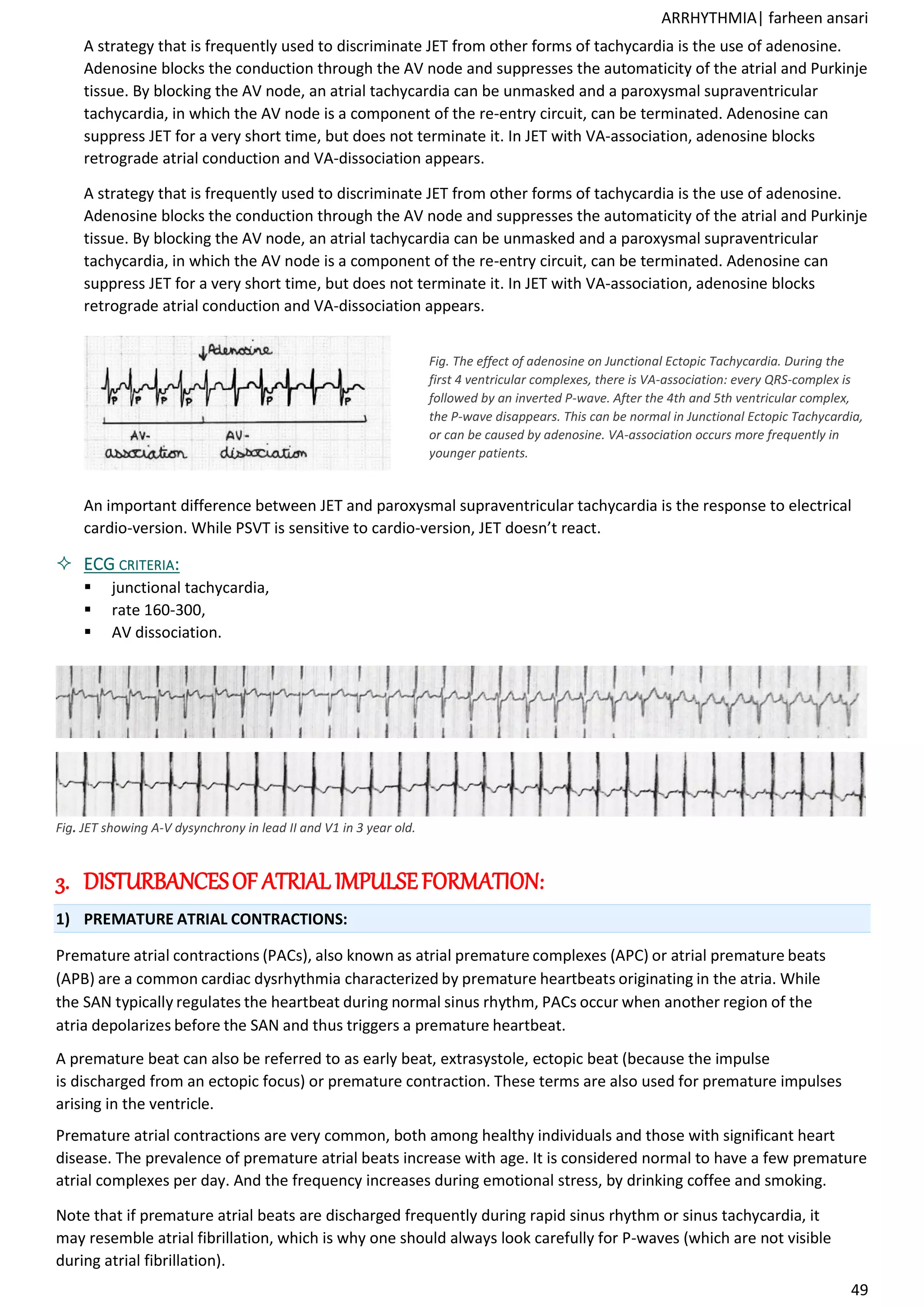 Arrhythmia: Mechanism, Classification, ECG features | PDF | Heart and ...