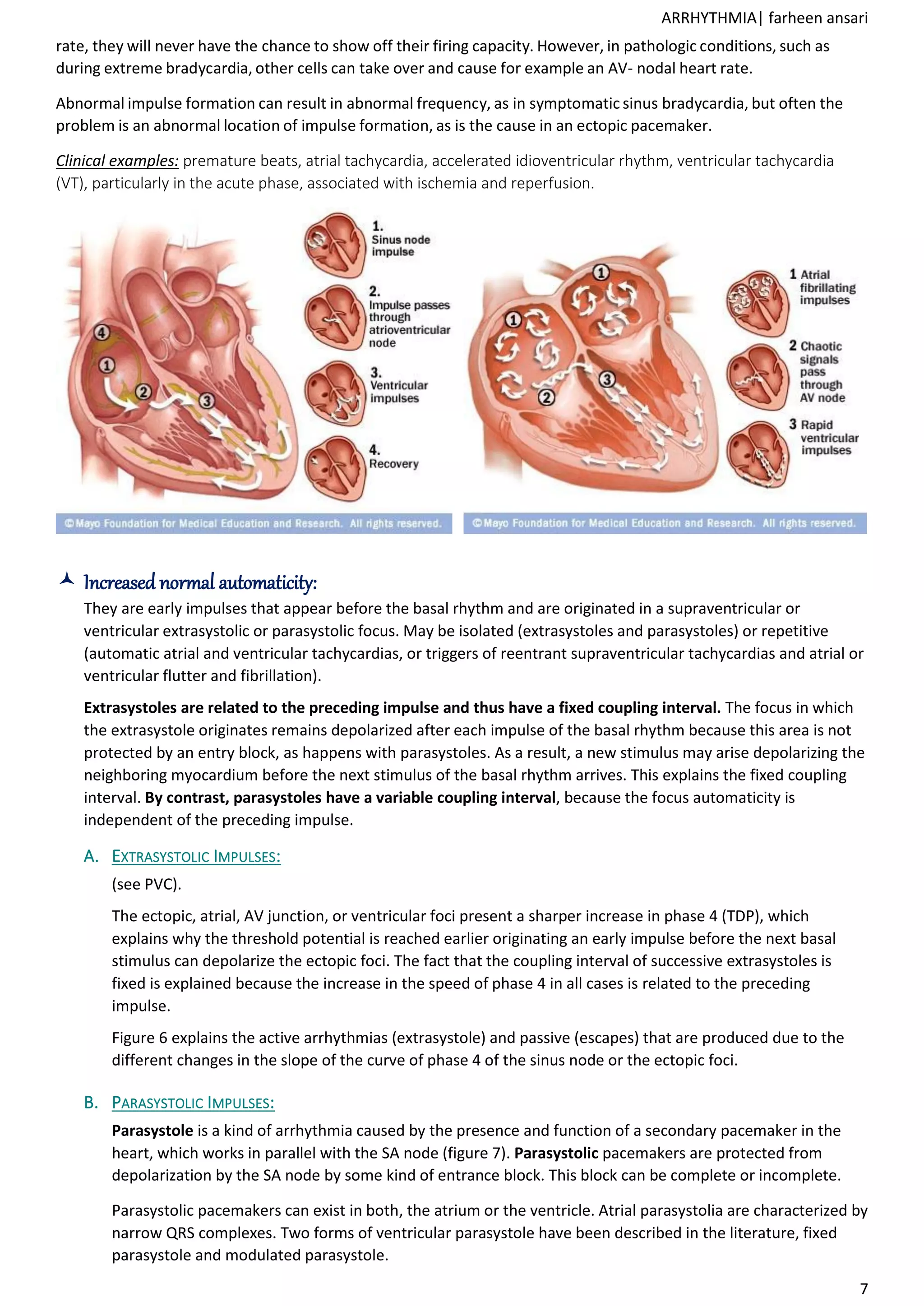 Arrhythmia: Mechanism, Classification, ECG features | PDF | Heart and ...