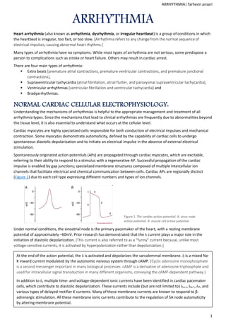 Arrhythmia: Mechanism, Classification, ECG features | PDF