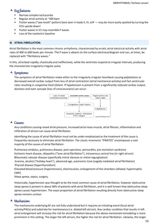 Arrhythmia: Mechanism, Classification, ECG features | PDF