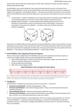 Arrhythmia: Mechanism, Classification, ECG features | PDF