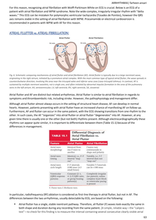 Arrhythmia: Mechanism, Classification, ECG features | PDF