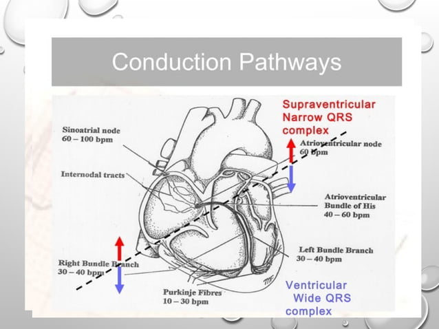Basics of Arrhythmia Medical Students2.pptx