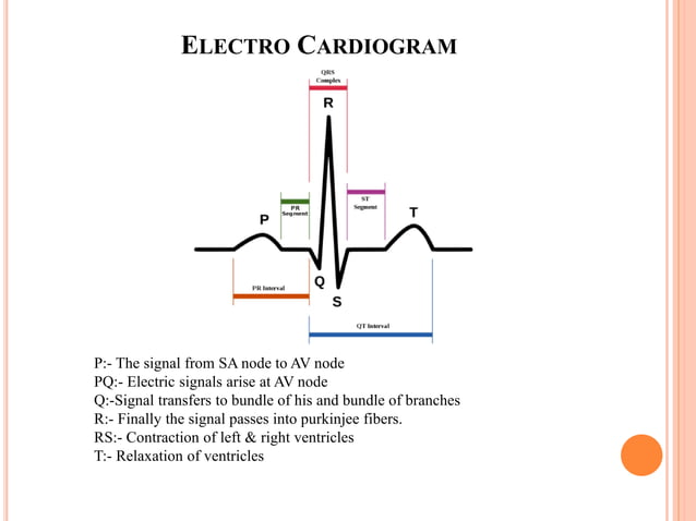 Arrhythmia ppt | PPT