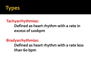 Arrhythmias | PPTX