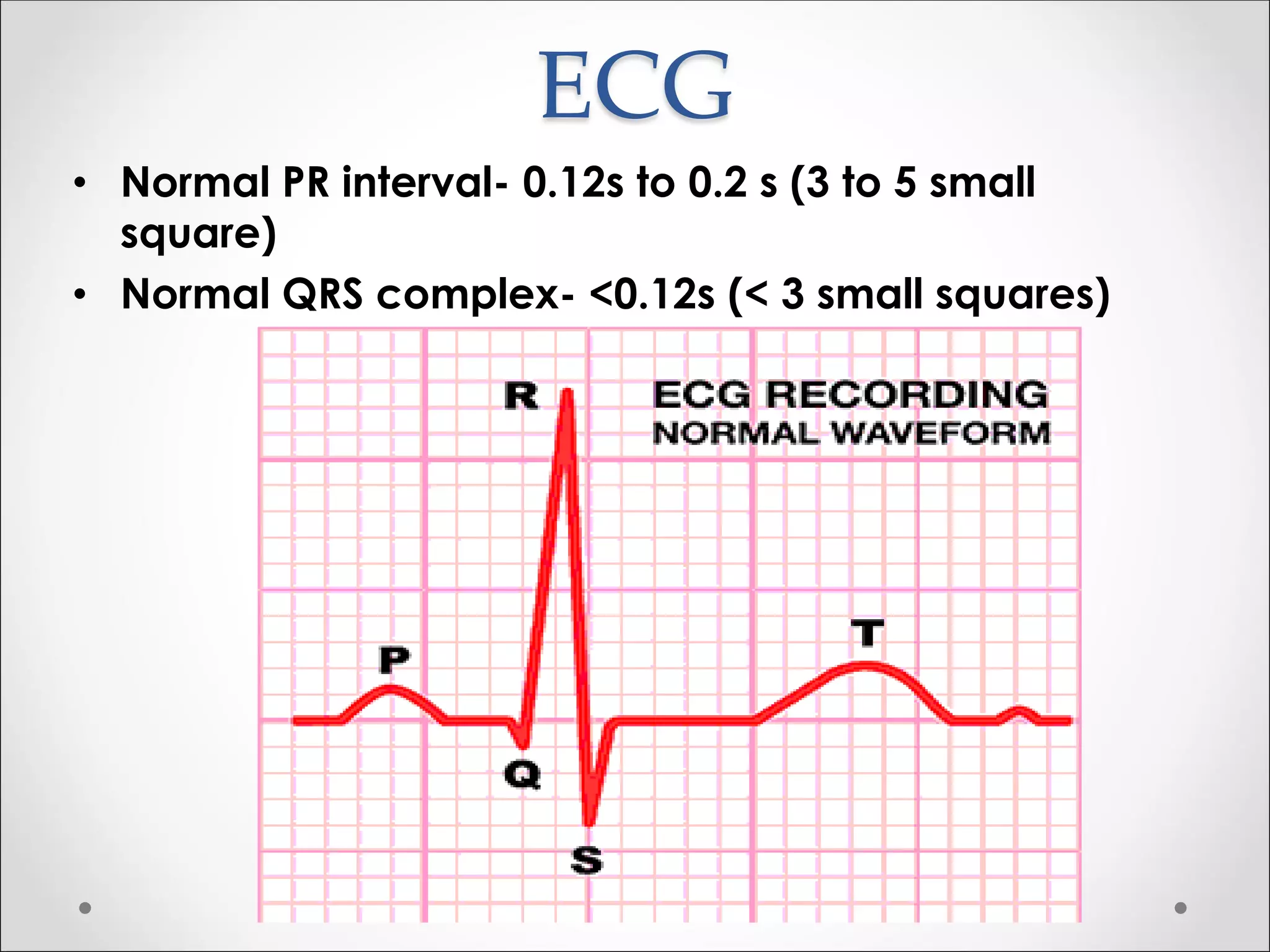 Arrhythmias | PDF