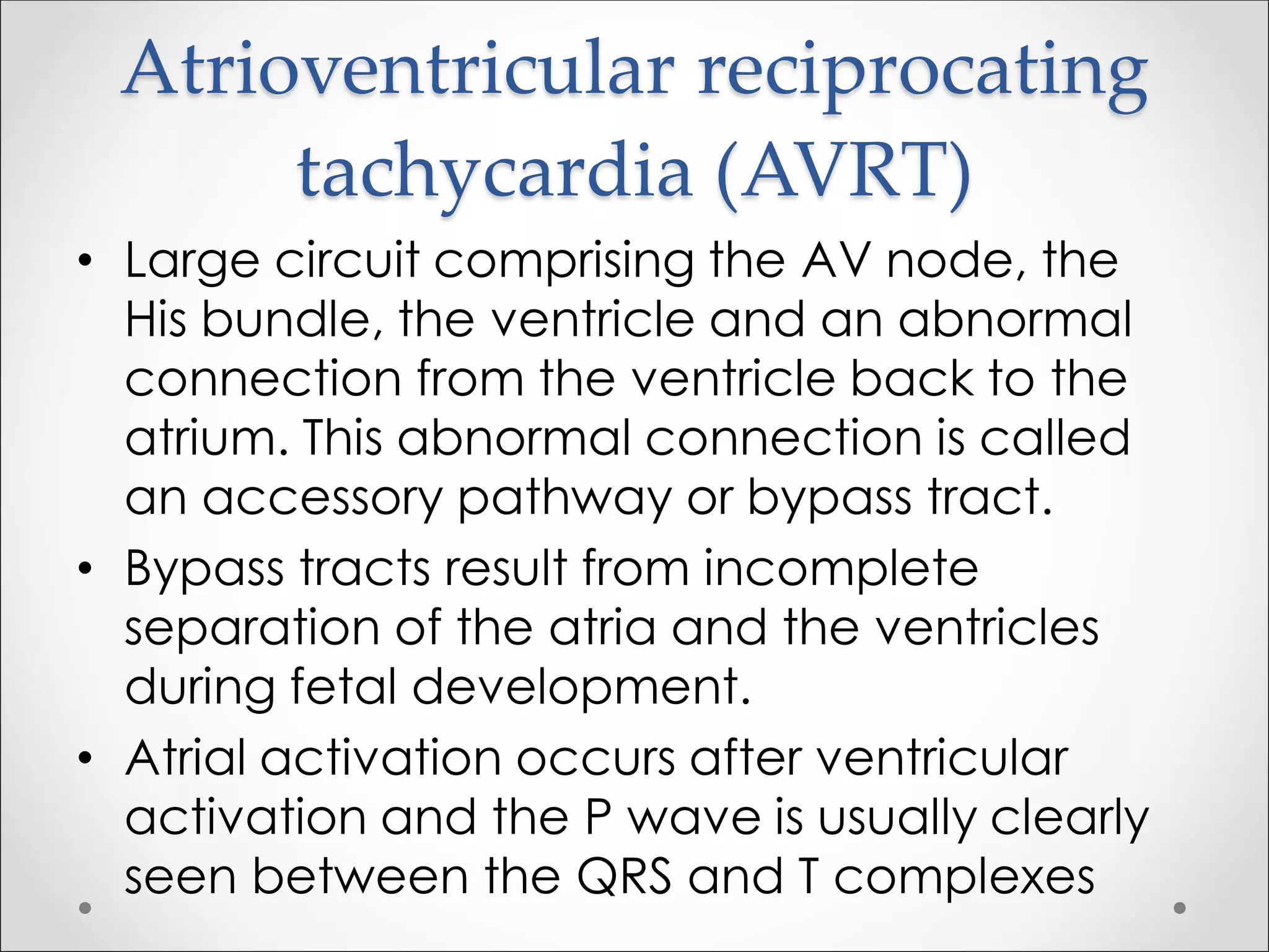 Arrhythmias | PDF