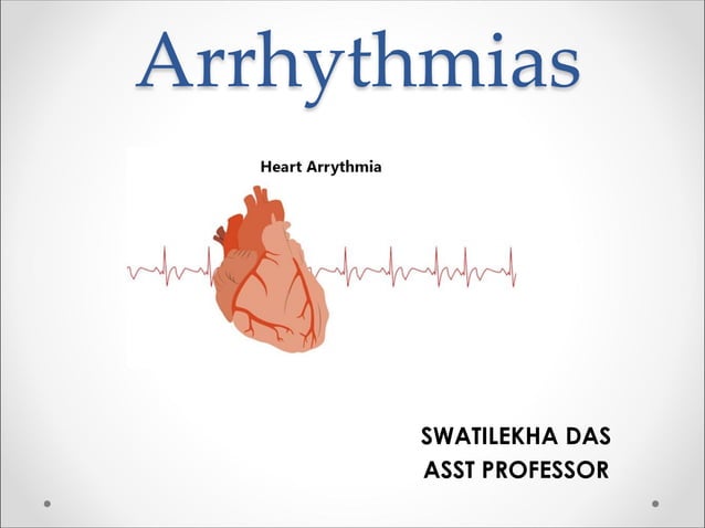 Arrhythmias | PDF | Heart and Cardiovascular Diseases | Diseases and Conditions