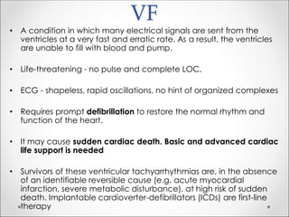 Arrhythmias | PDF