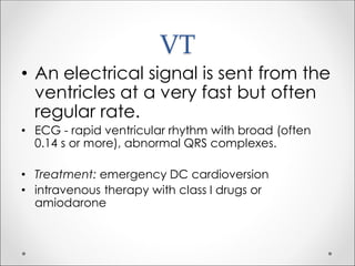 Arrhythmias | PDF