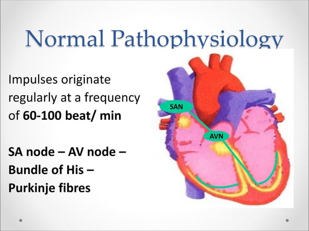 Arrhythmias | PDF | Heart and Cardiovascular Diseases | Diseases and Conditions