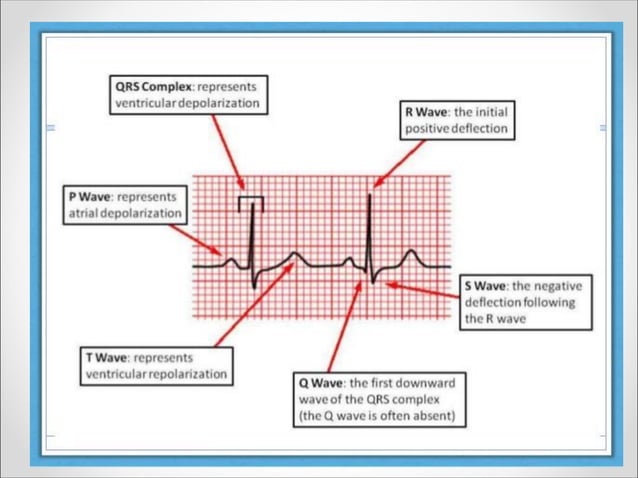 Arrhythmias | PDF | Heart and Cardiovascular Diseases | Diseases and Conditions