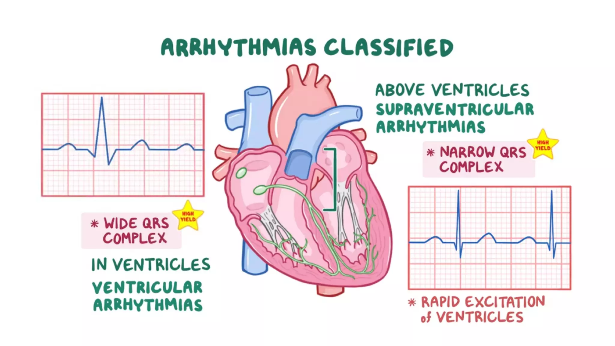 Arrhythmias | PDF