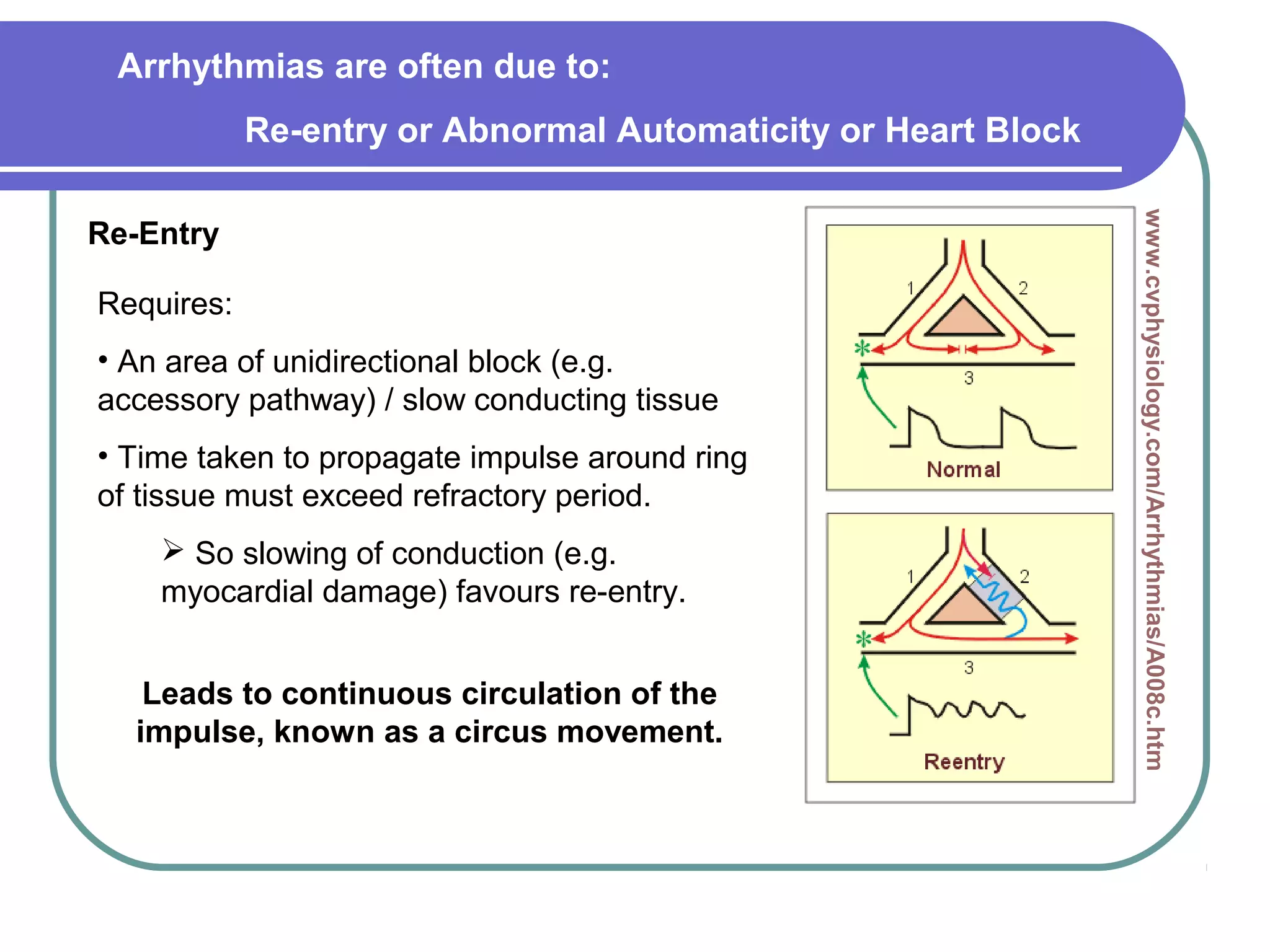 Arrhythmias | PPT