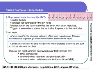 Arrhythmias | PPT