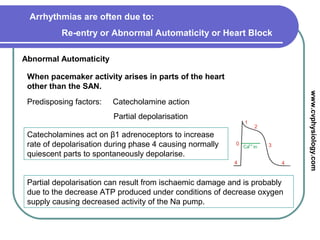 Arrhythmias | PPT