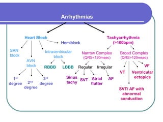 Arrhythmias | PPT