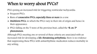 Perioperative Arrythmias and management | PPTX