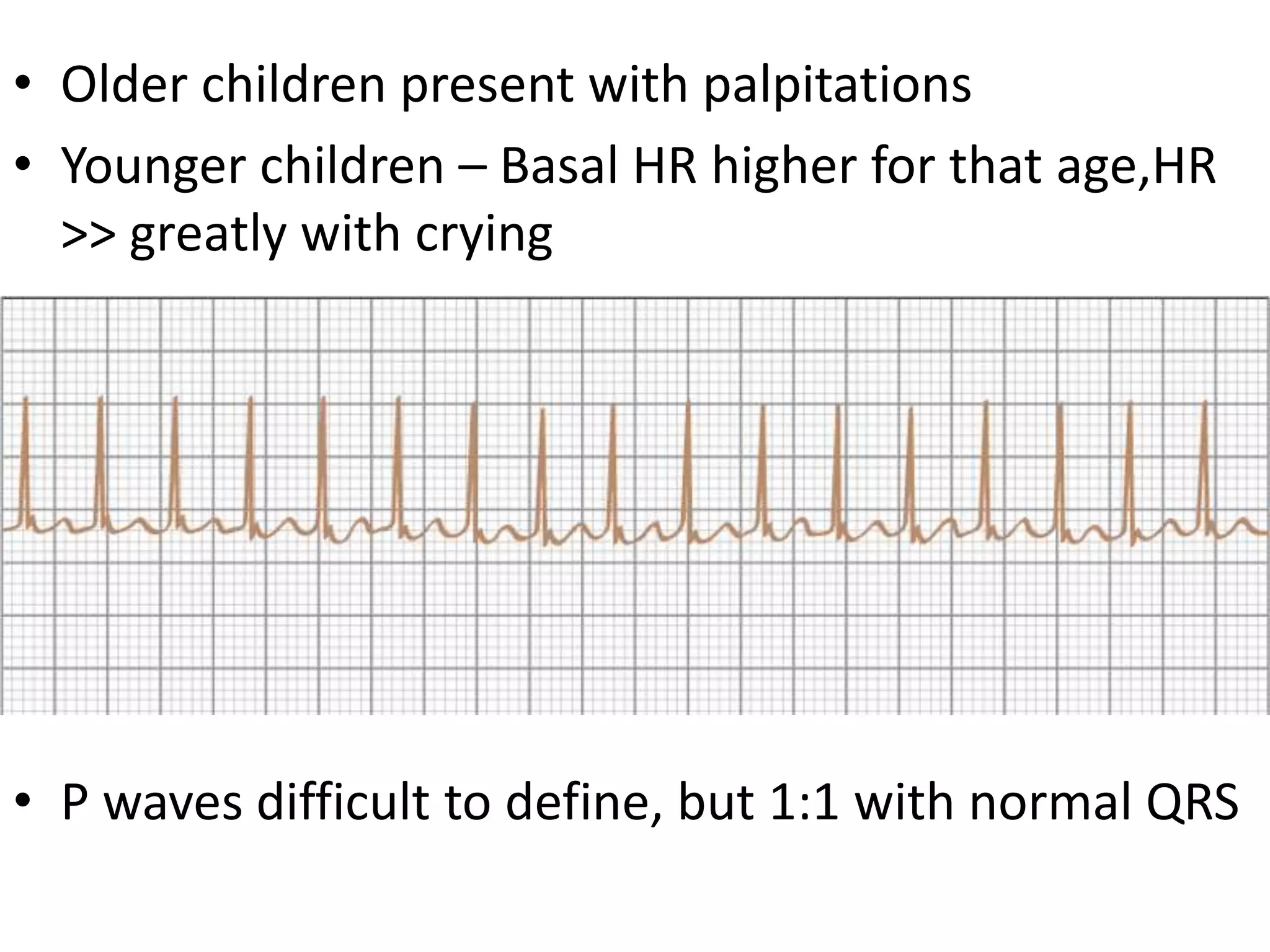 Arrhythmias in children | PPTX