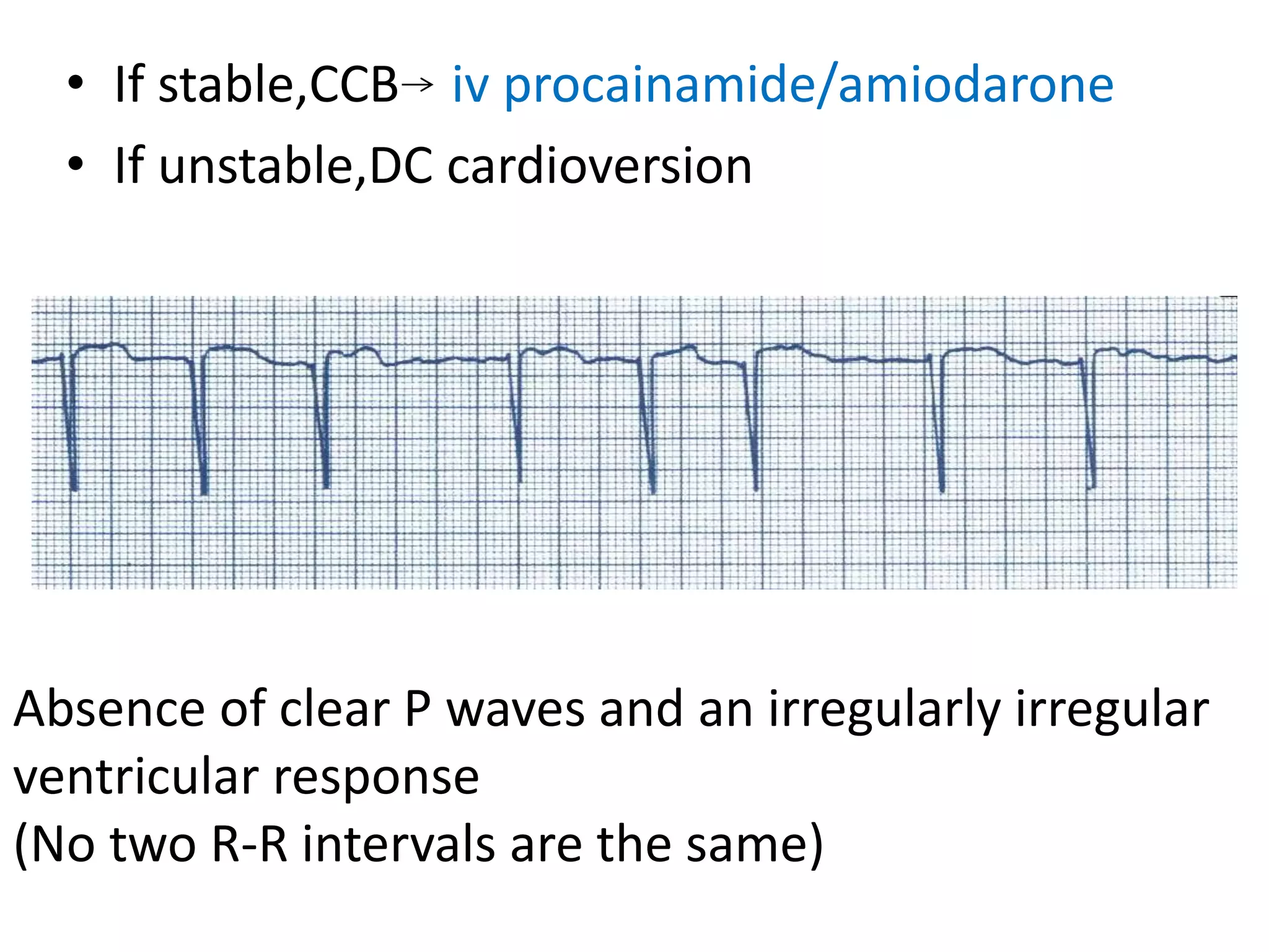 Arrhythmias in children | PPTX