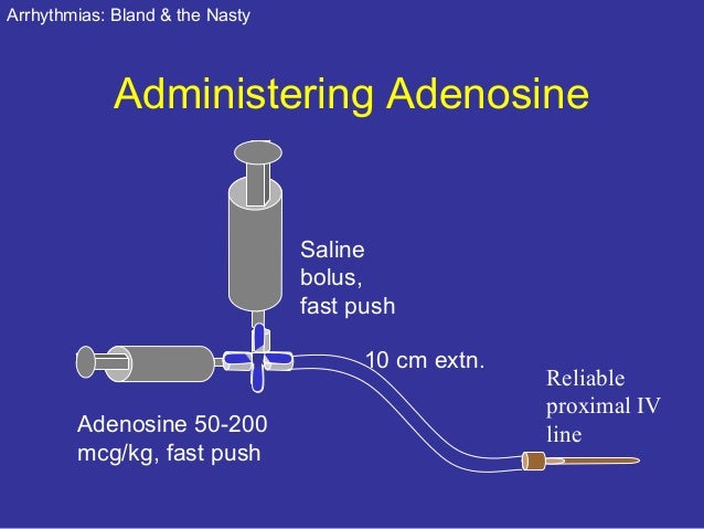 Arrhythmias – clinical features