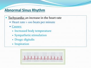 Arrhythmias copy.pptxyyyy677777777777777777 | PPT