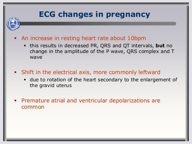 Arrhythmias in preg