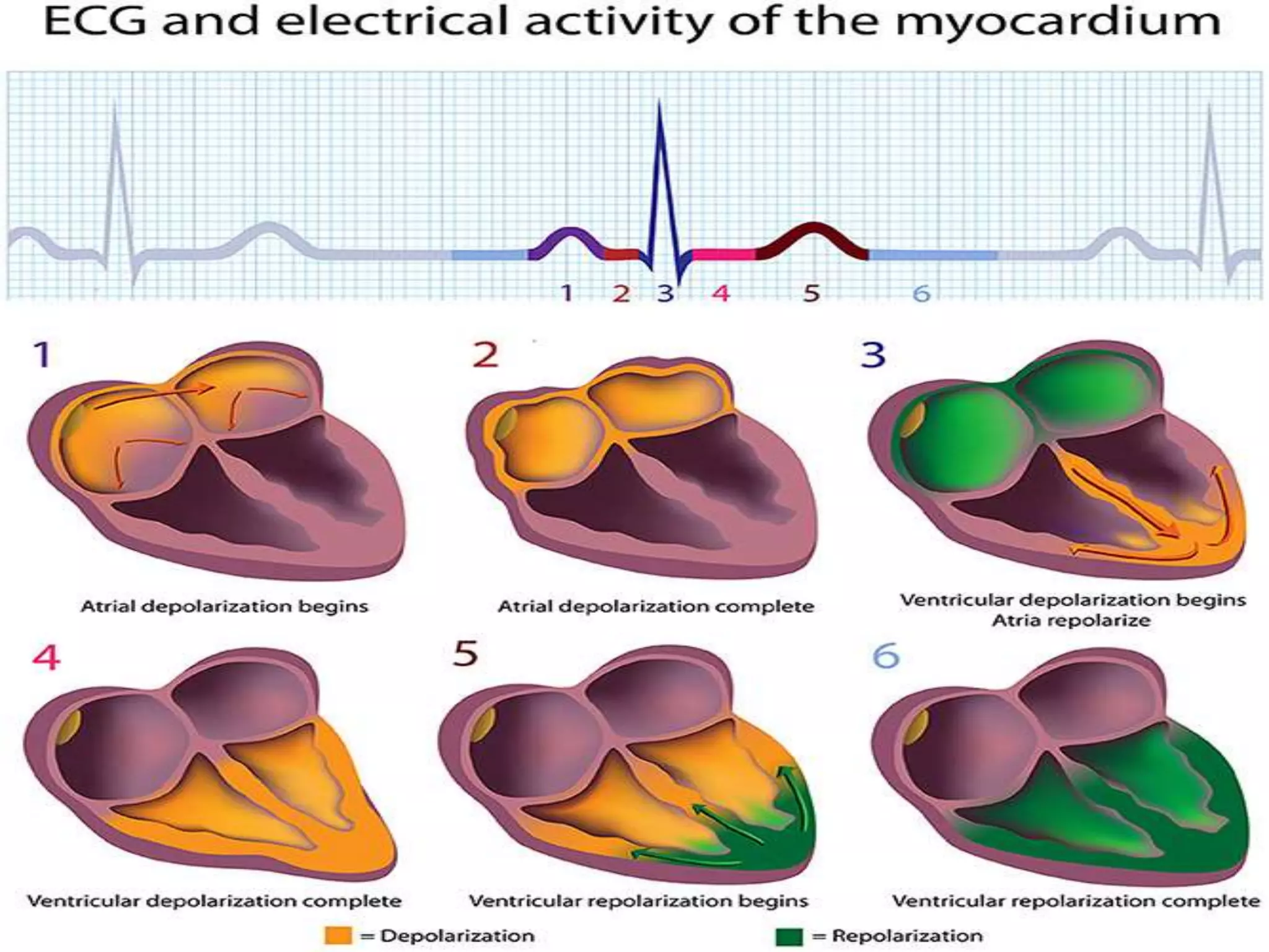 cardiac arrhythmias | PPT