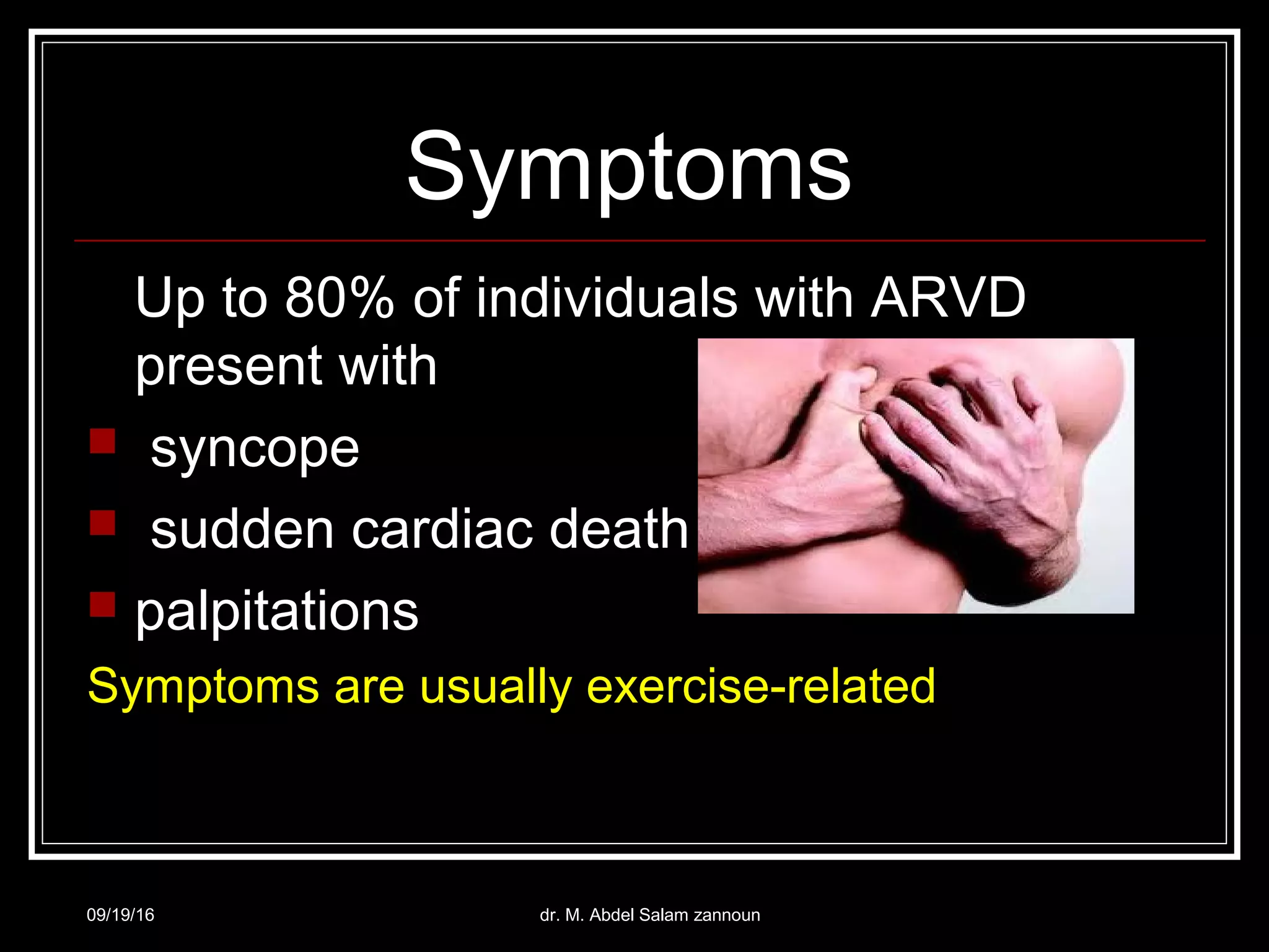 Arrhythmogenic right ventricular dysplasia | PPT