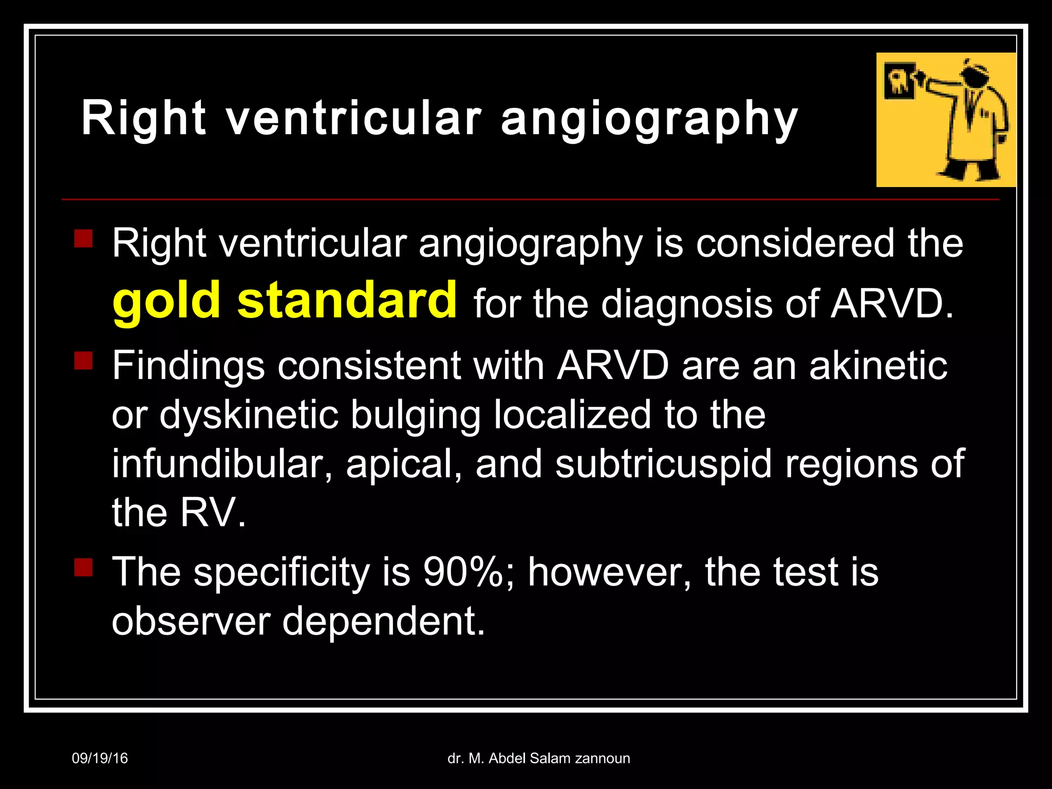Arrhythmogenic right ventricular dysplasia | PPT