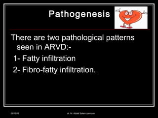 Arrhythmogenic right ventricular dysplasia | PPT