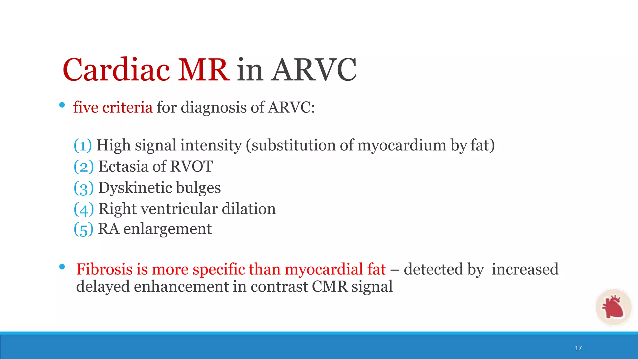 Arrhythmogenic right ventricular dysplasia - ARVD | PPTX
