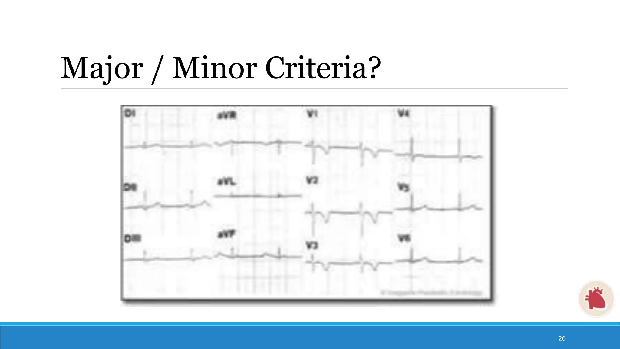 Arrhythmogenic right ventricular dysplasia - ARVD | PPTX