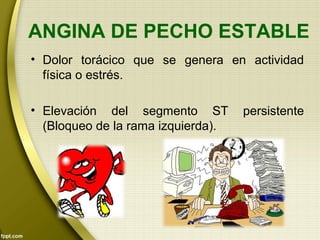 Arritmias angina | PPT