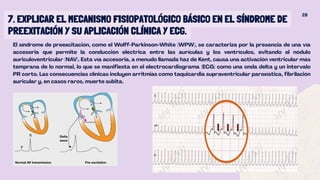 Fisiopatología de las Arritmias Cardíacas.pdf
