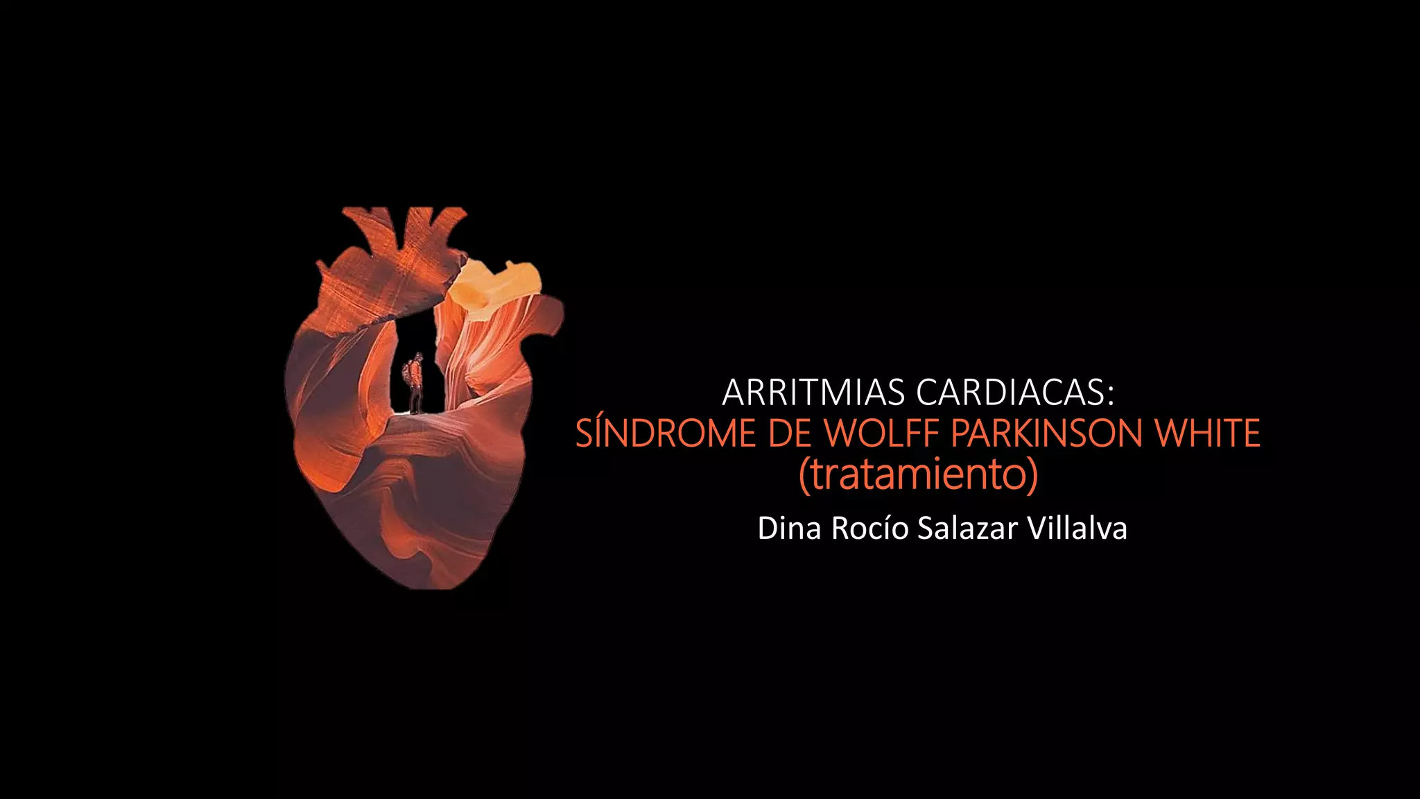 Arritmias cardiacas: Síndrome de Wolf Parkinson White /Tratamiento ...