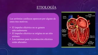 Arritmias Cardiacas.pptx