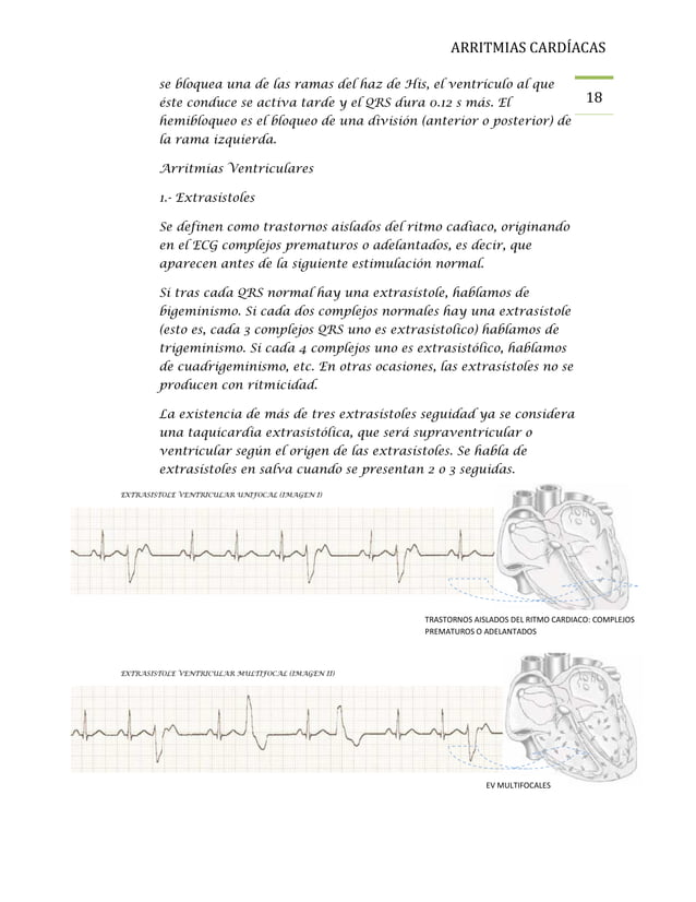 Manual de ARRITMIAS CARDIACAS abordaje clínico | PDF