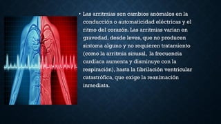 Arritmias cardiacas área de cardiología- | PDF