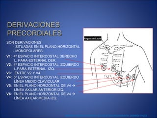 electrocardiografia basica y Arritmias | PPT