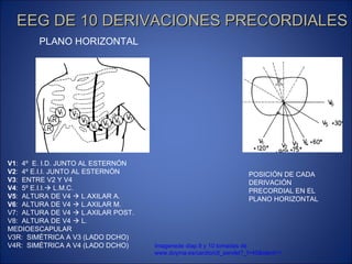 electrocardiografia basica y Arritmias | PPT