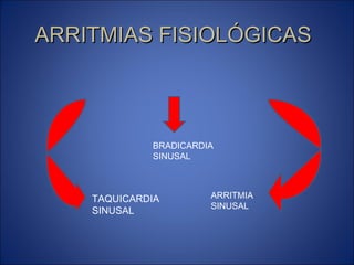 electrocardiografia basica y Arritmias | PPT