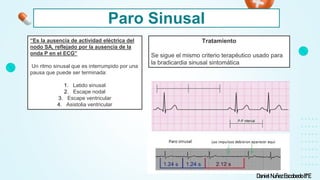 Arritmia Sinusal.pptx