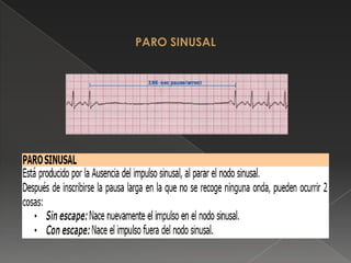 ECC y arritmias cardiacas. | PPTX