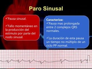 Arritmias supraventriculares ramos | PPT
