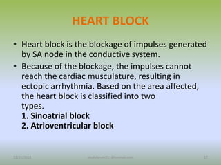 arrythmia-181225195204 2.pdf