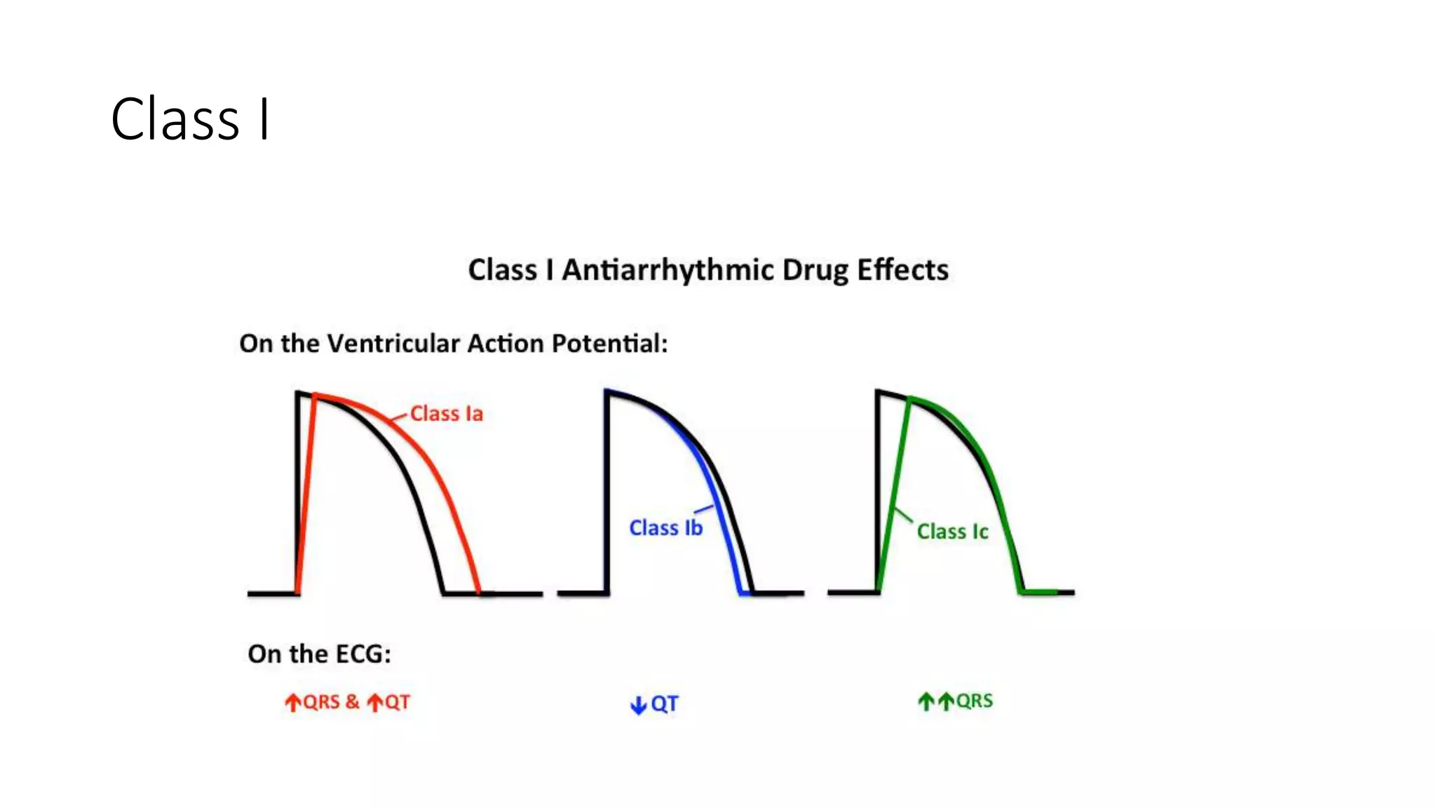 Types of Arrythmia and Anti Arrythmic Drugs .pptx