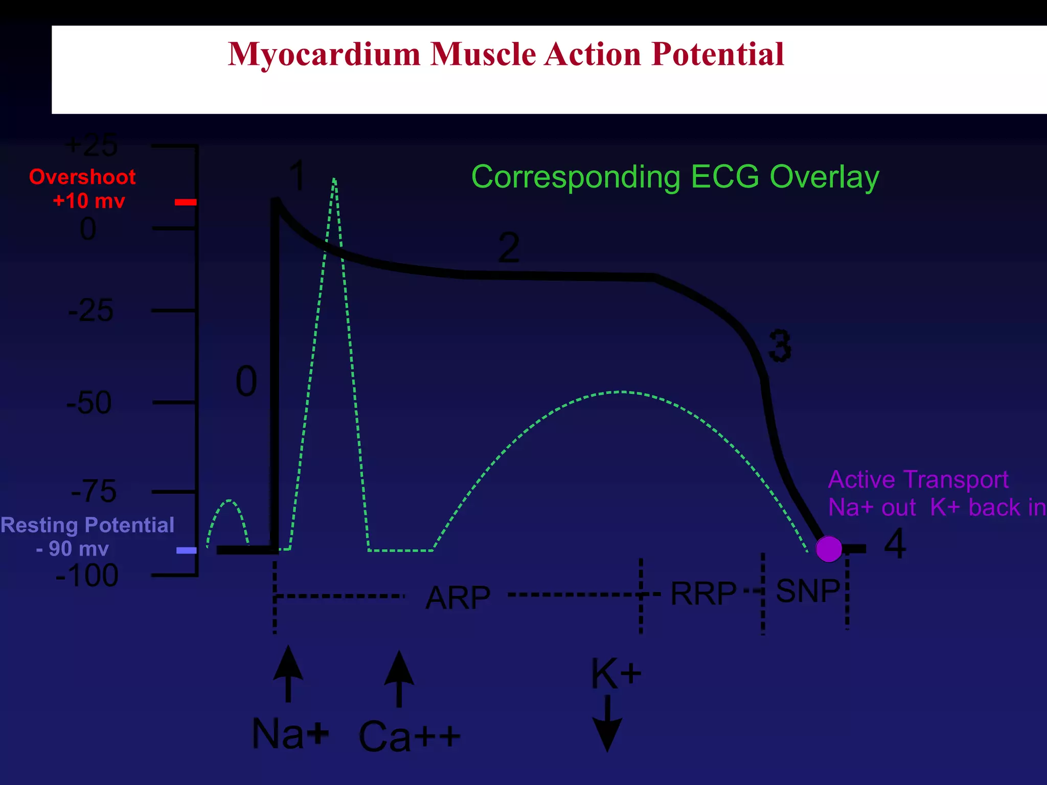 Arrythmia 411.ppt