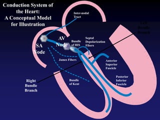 Arrythmia 411.ppt